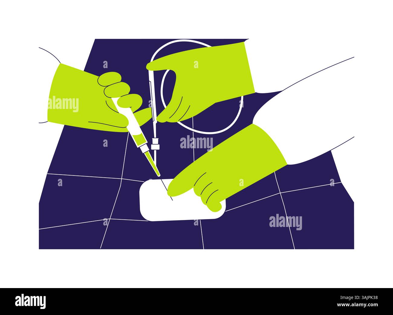 Endovascular surgery abstract concept vector illustration Stock Vector ...