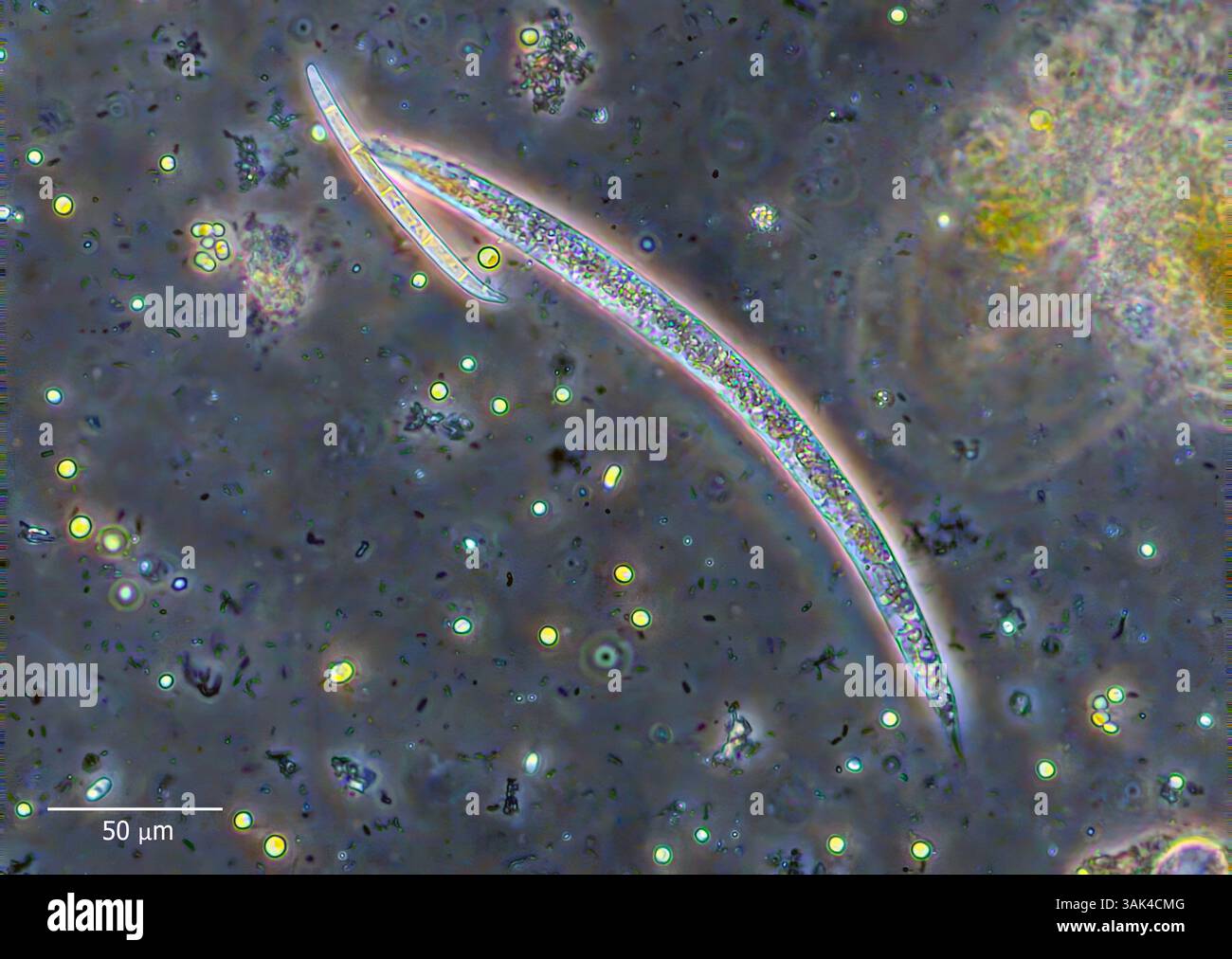 Macroconidia (microscopic asexual spores) produced by the fungus ...