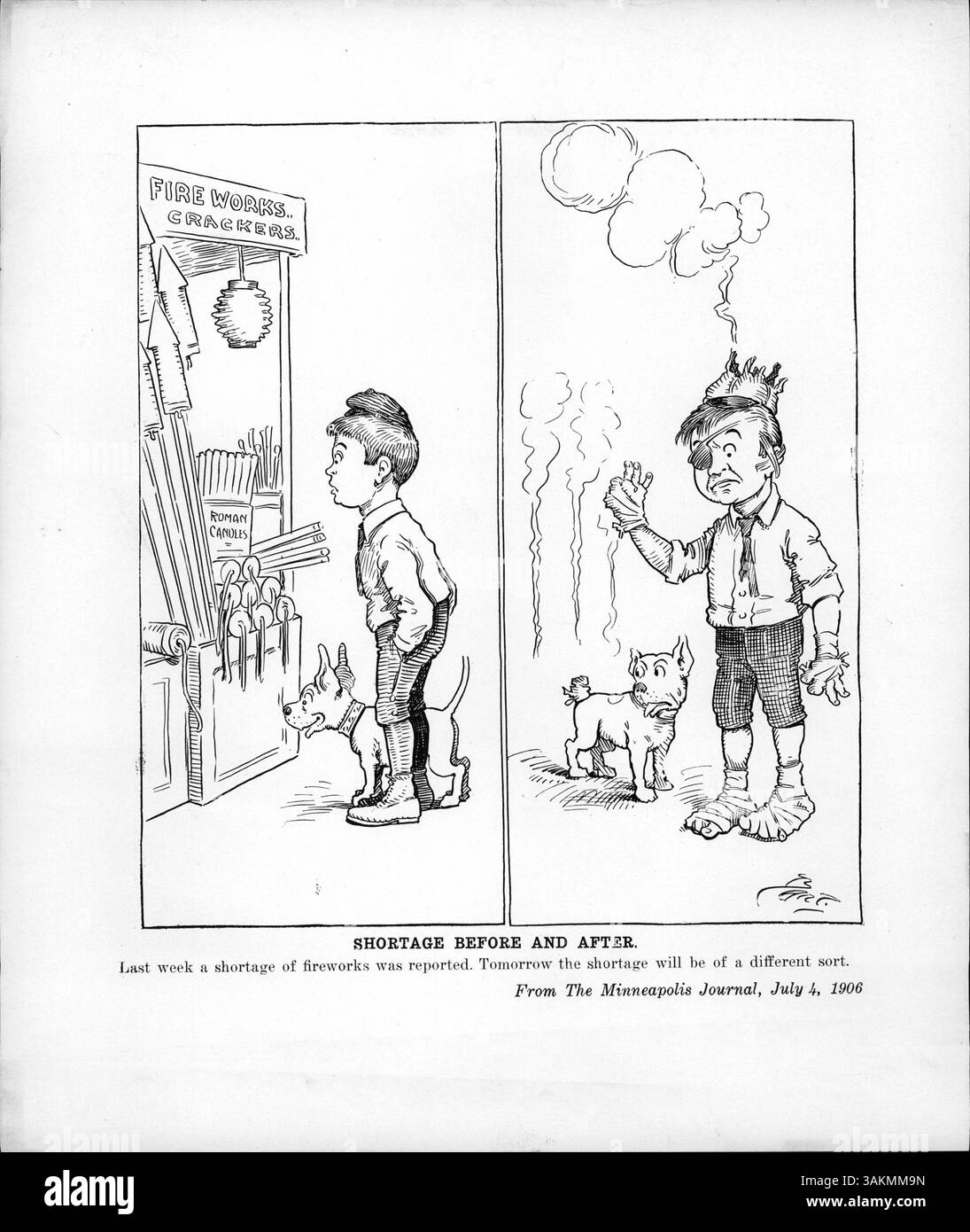 This illustration depicts a child before and after a fireworks accident ...