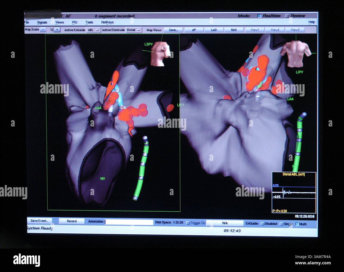 April 21, 2006 - U.S. - Dr. Christopher Cole performs a procedure ...