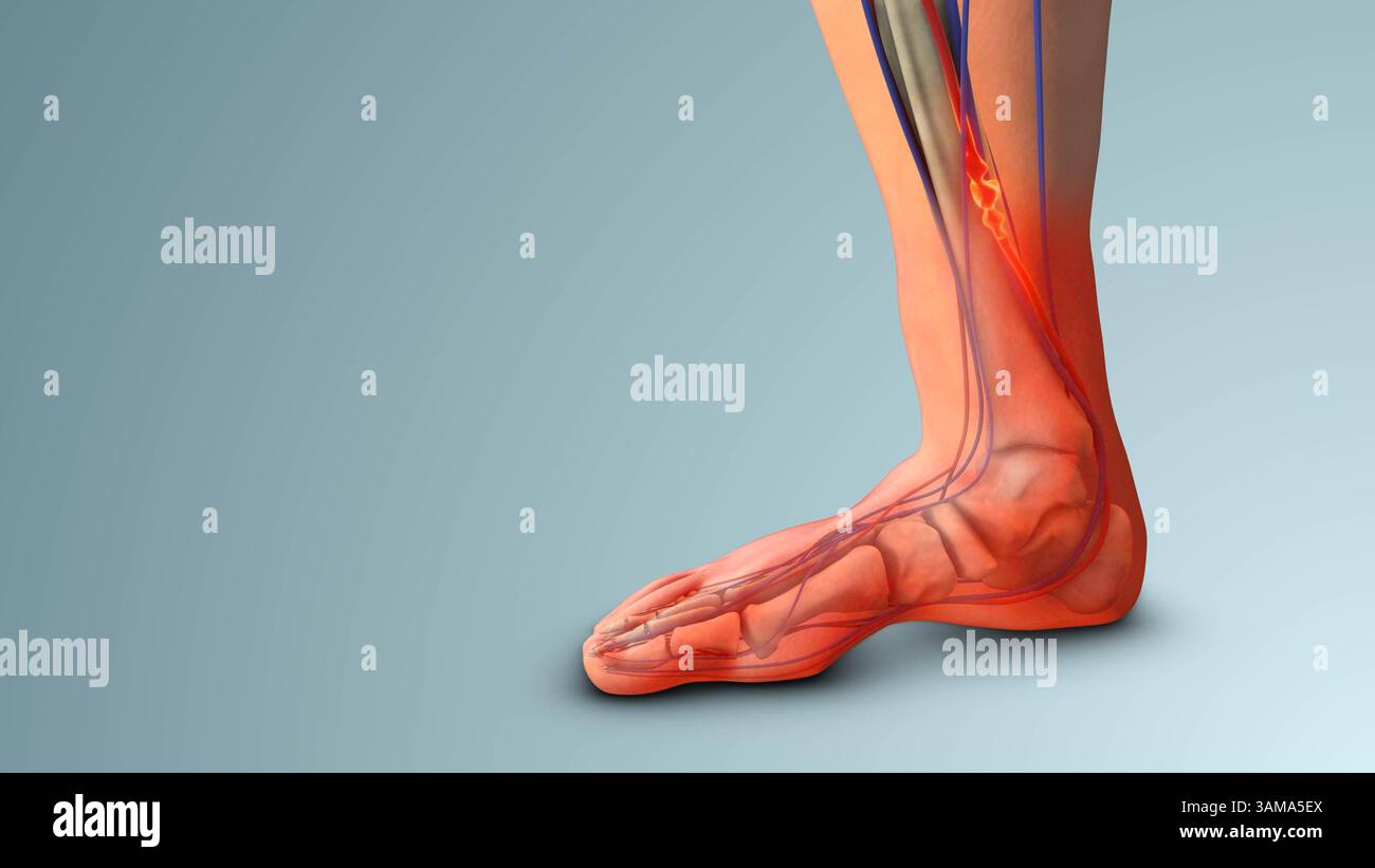 Leg Swelling and Pain from Vein Thrombosis Stock Photo - Alamy