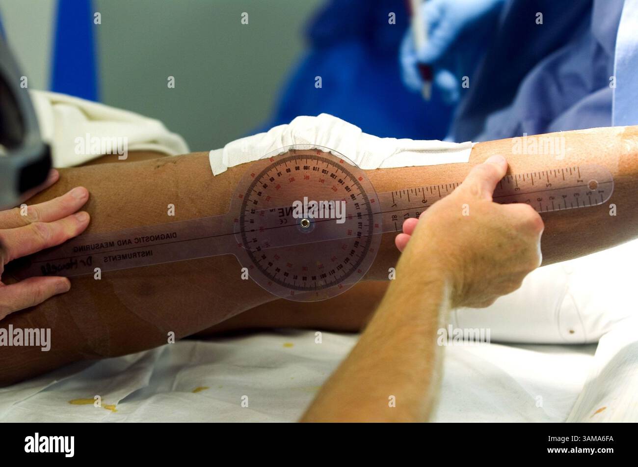 Total knee replacement hi-res stock photography and images - Alamy