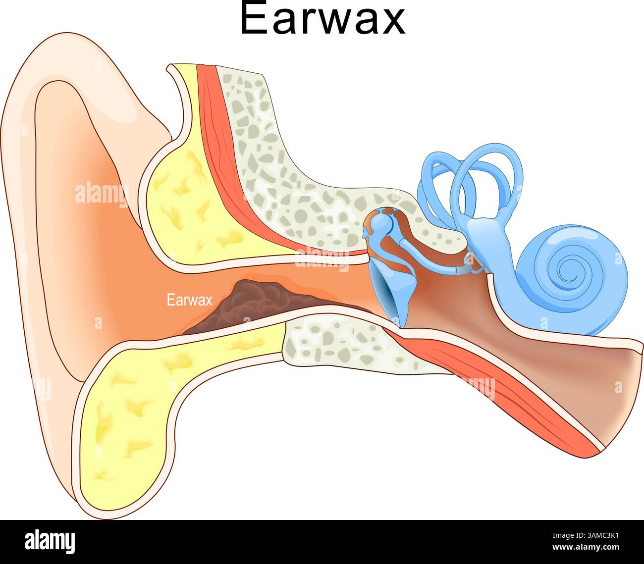 Earwax. Cross section of a human ear with Cerumen in External auditory ...