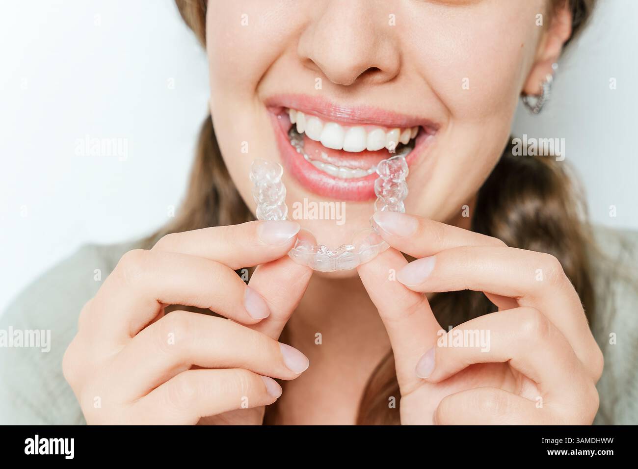 Close-up of smiling woman inserting clear transparent aligner in mouth ...