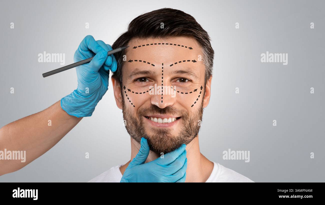 Surgeon hands making marks on smiling man face Stock Photo - Alamy