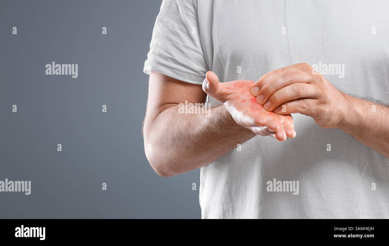 Annoyed middle aged man scratching his palm Stock Photo - Alamy