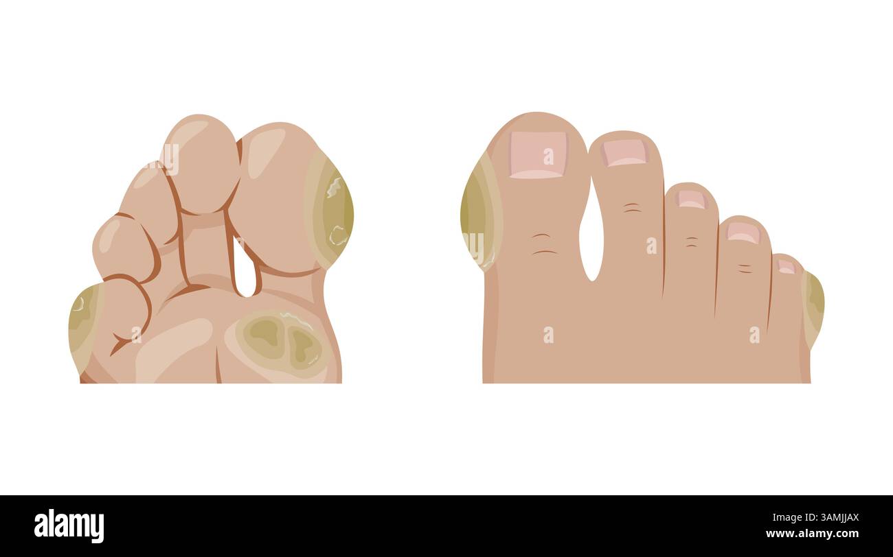 Foot sole dry Cut Out Stock Images & Pictures - Alamy