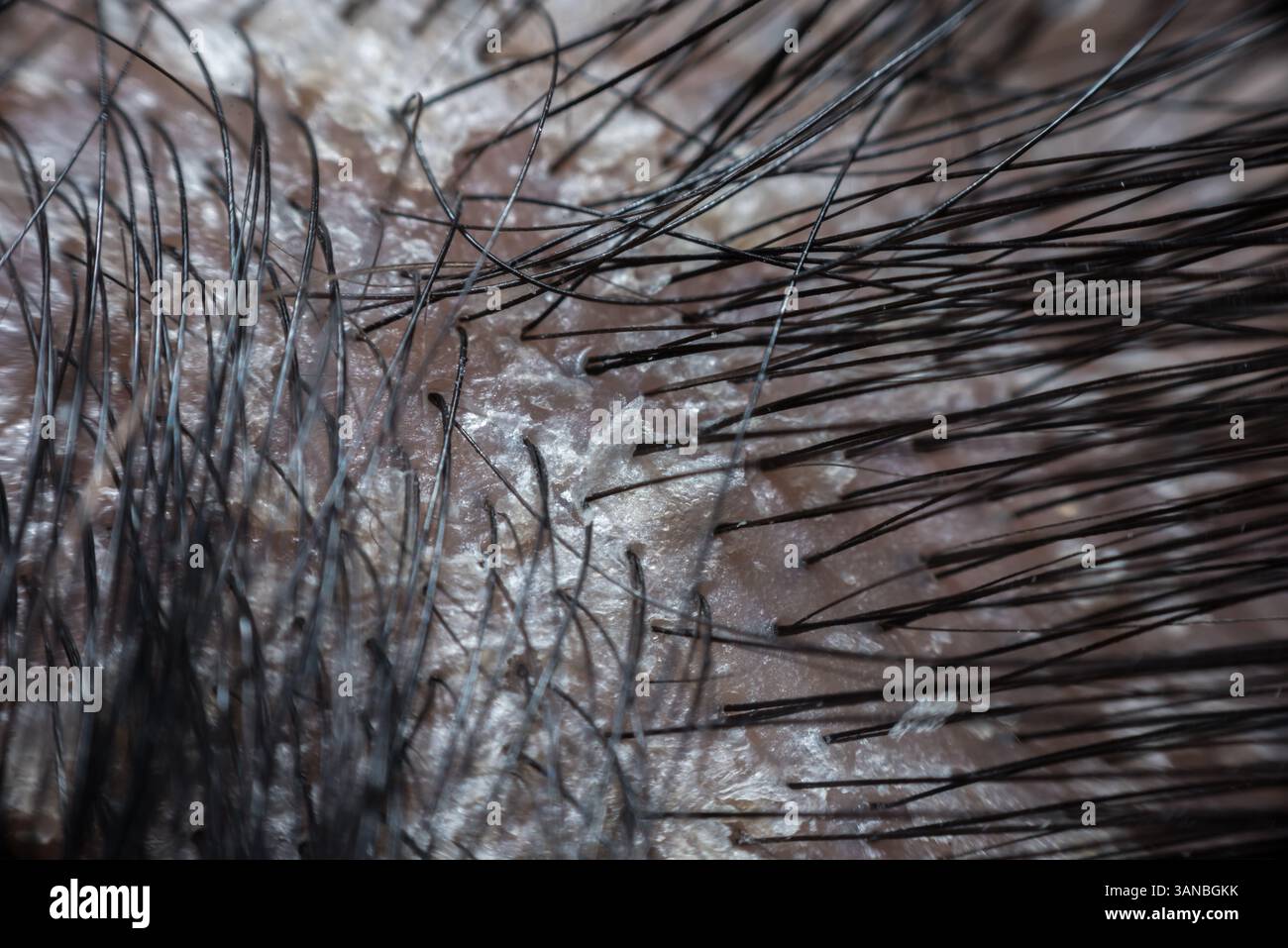 Macro of hair scalp asian human with black hairline have a problem with ...