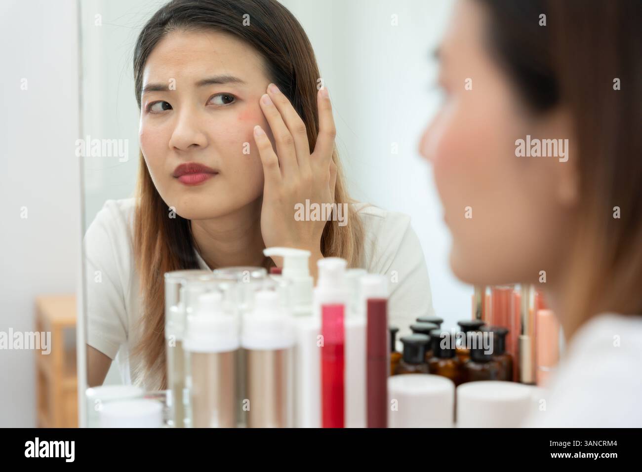 Woman worried about face Dermatology, rosacea dermatitis, allergic steroids, sensitive skin, red ...