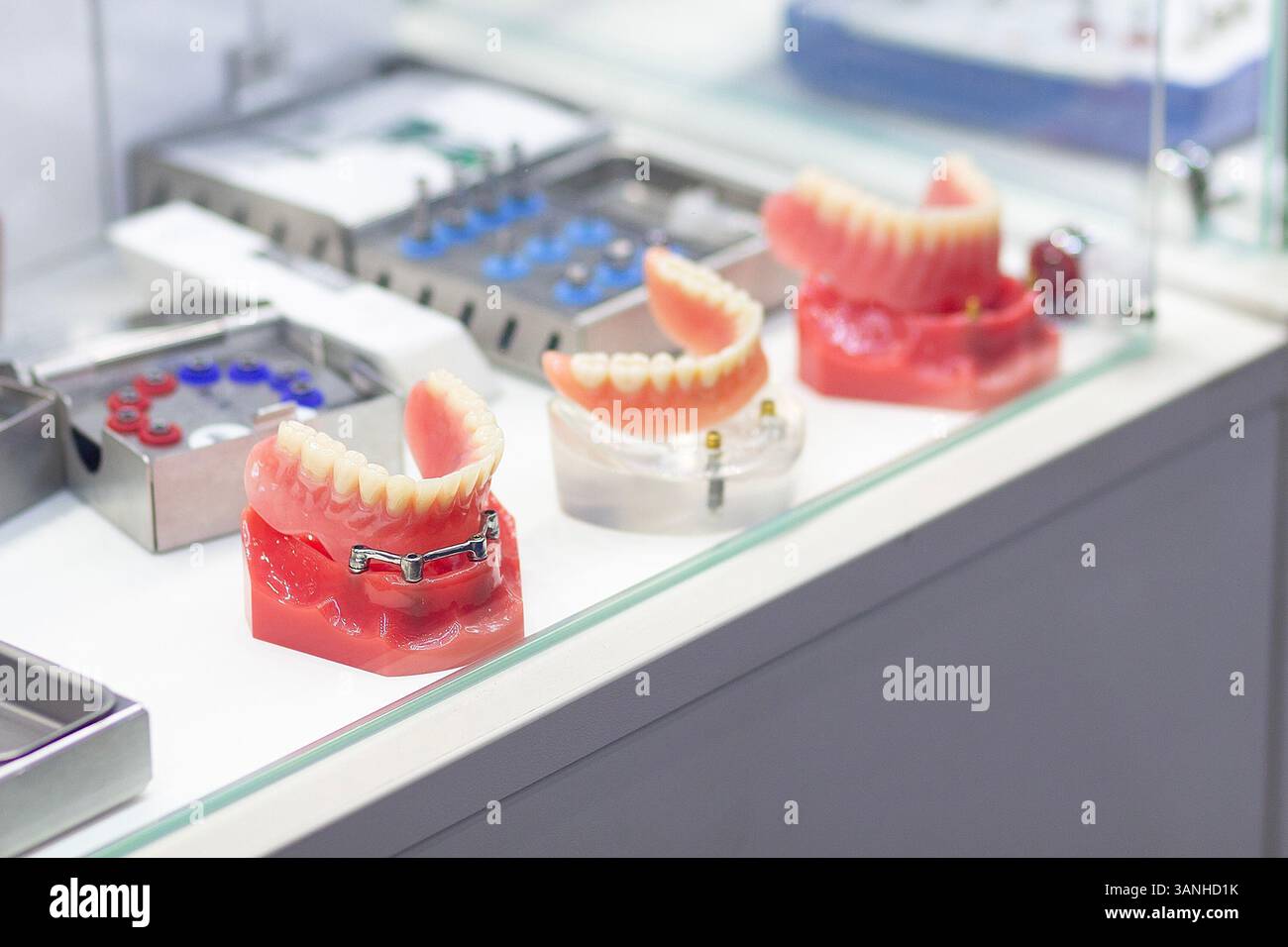 Human dental prosthetics samples on the stand. Dentistry Stock Photo ...