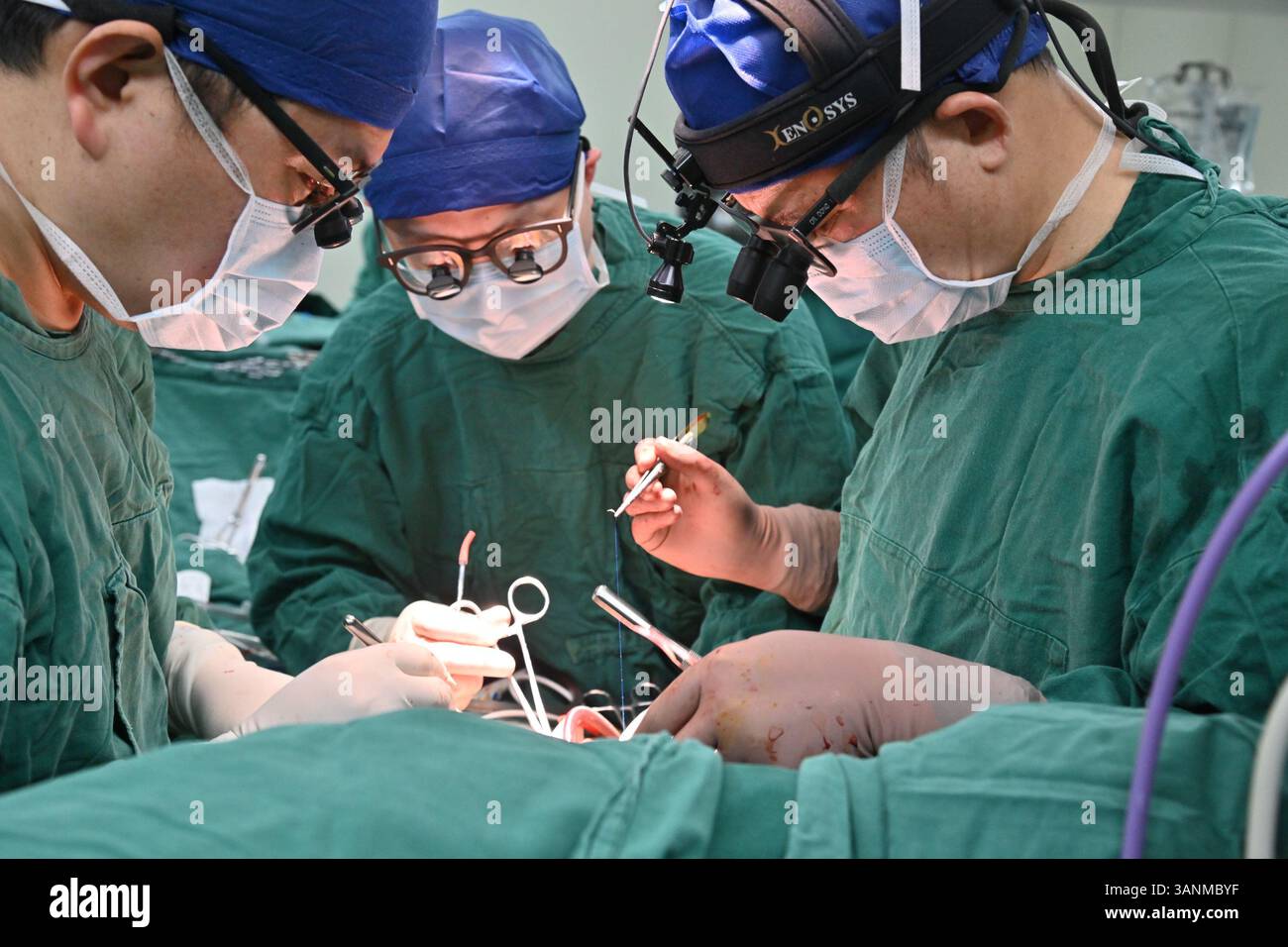 (250415) -- WUHAN, April 15, 2025 (Xinhua) -- Medical workers implant a magnetically levitated ...