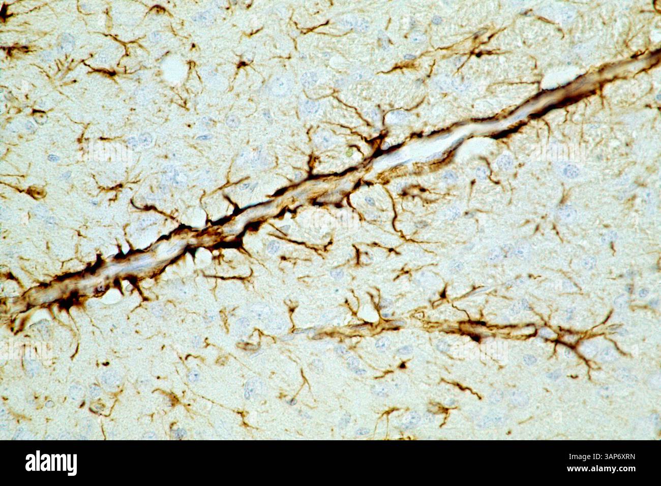 Light micrograph of the cerebral cortex immunostained for glial ...