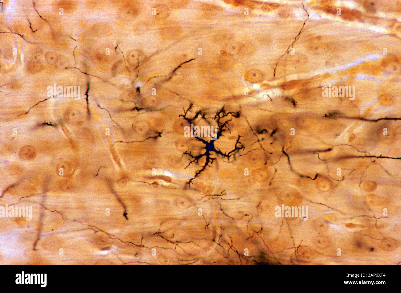 Light micrograph of a single microglia in the cerebral cortex. Rio ...