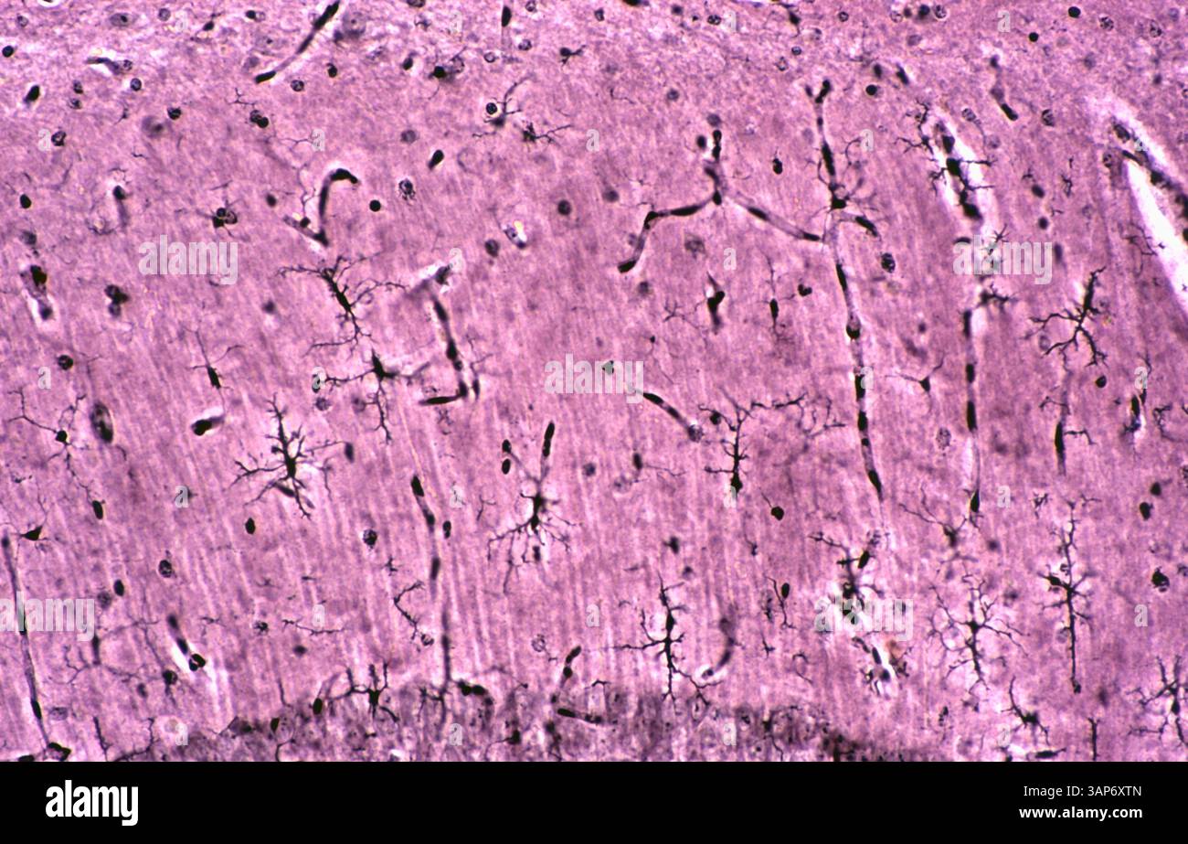 Light micrograph of microglia cells of the hippocampus (Ammon horn ...