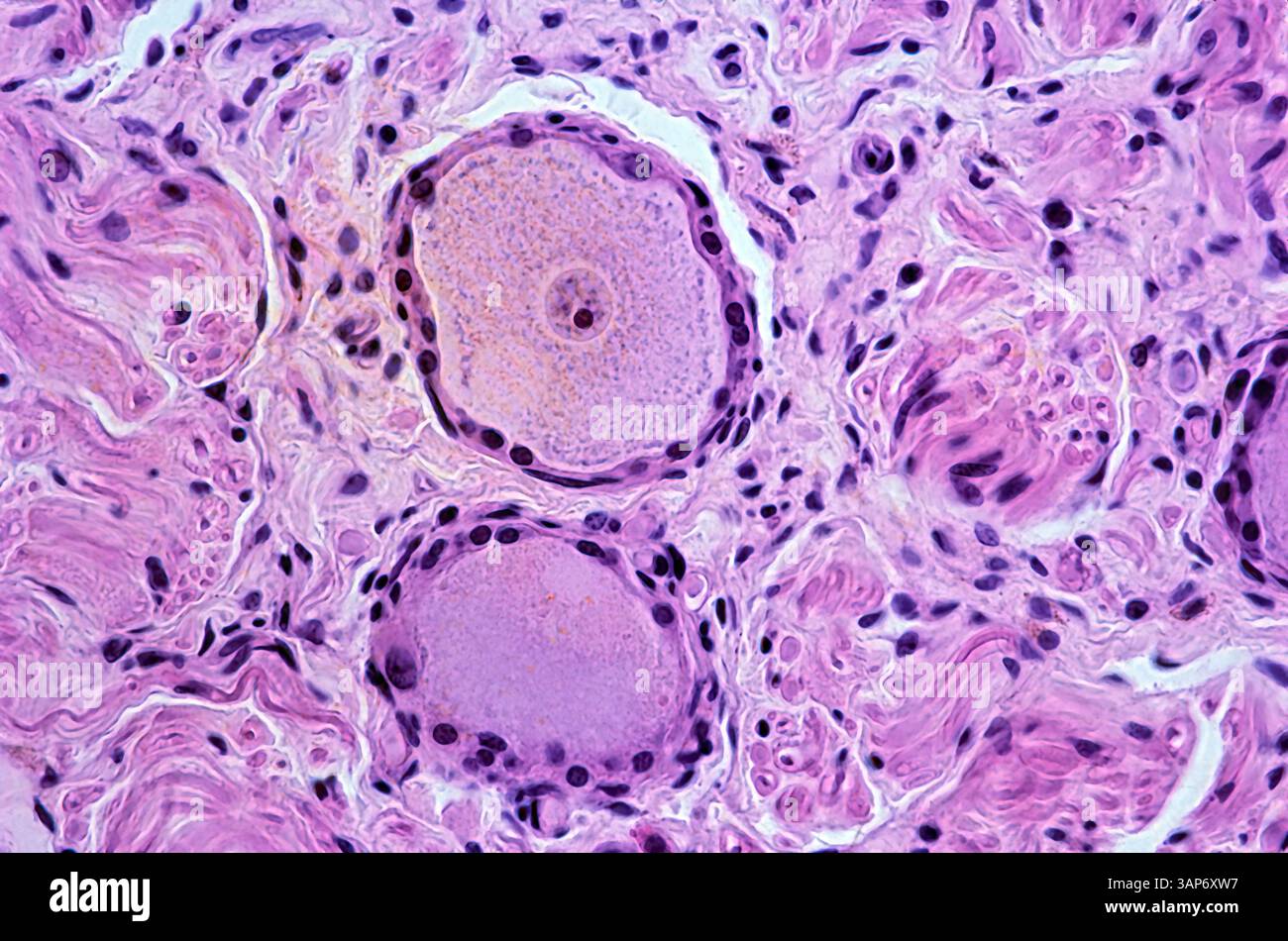 Neurons of human sympathetic ganglion, light micrograph. Each large ...