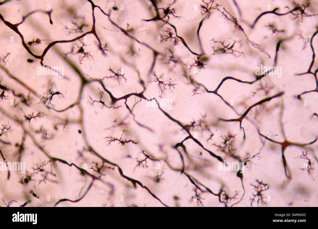 Light micrograph of microglia in the cerebral cortex. Rio-Hortegaâ€™s ...
