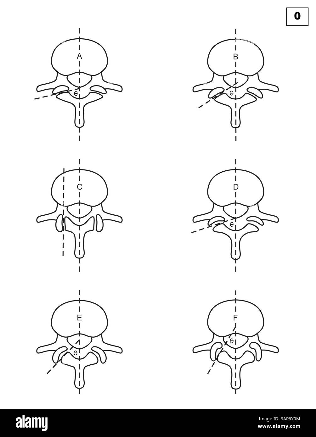 Illustration of axial views of the lumbar (lower back) vertebrae Stock ...