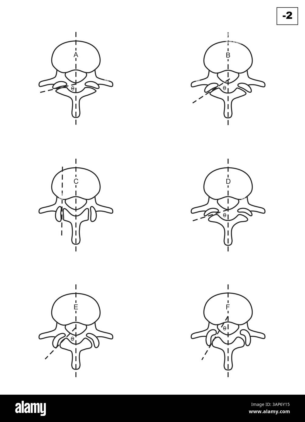 Illustration of axial views of the lumbar (lower back) vertebrae Stock ...