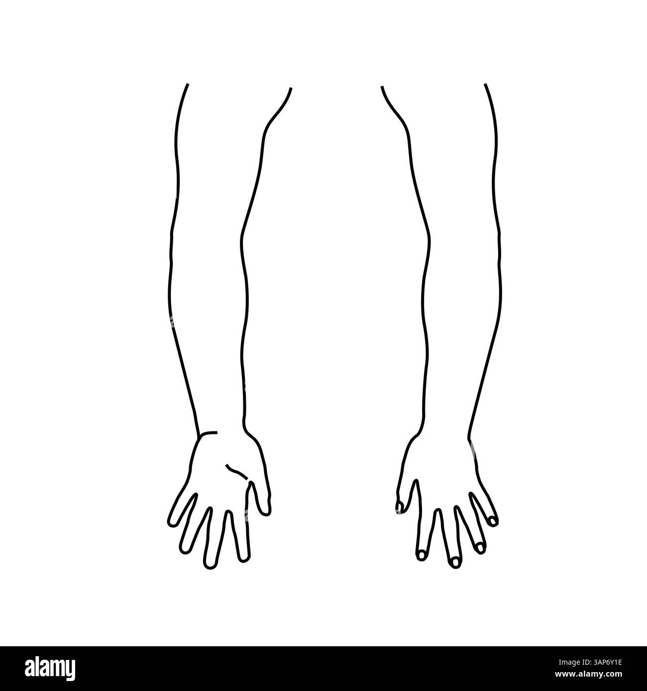 Illustration of the left arm Stock Photo - Alamy