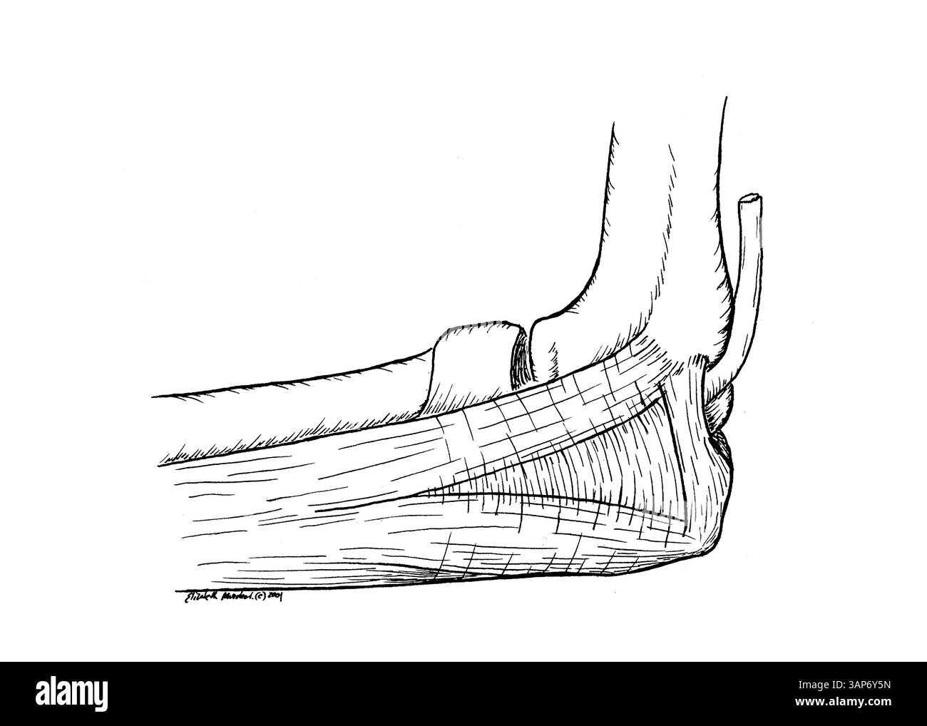 Illustration of the cubital tunnel of the elbow, showing the anatomical ...
