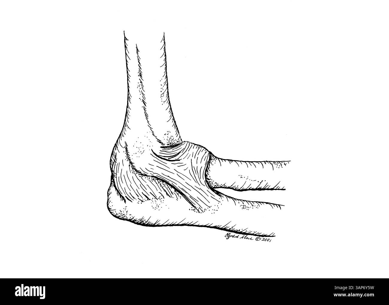 Illustration of a lateral view of an elbow, showing the anatomical ...