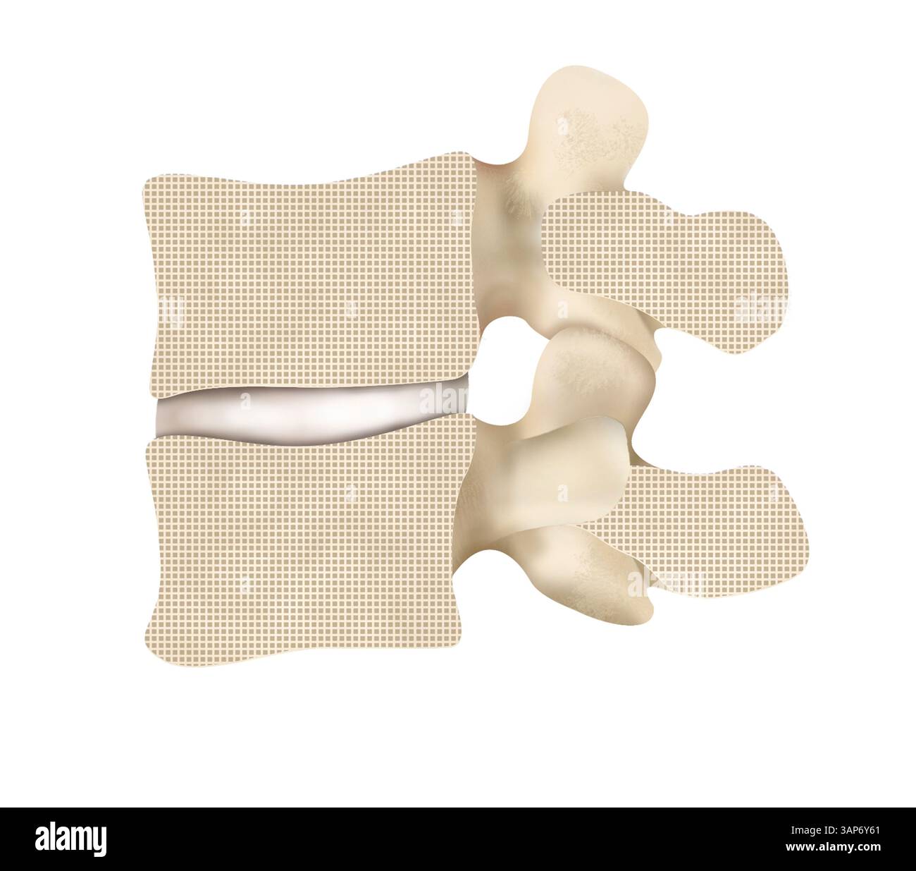 Illustration of a lateral view of vertebrae, showing the vertebral body ...