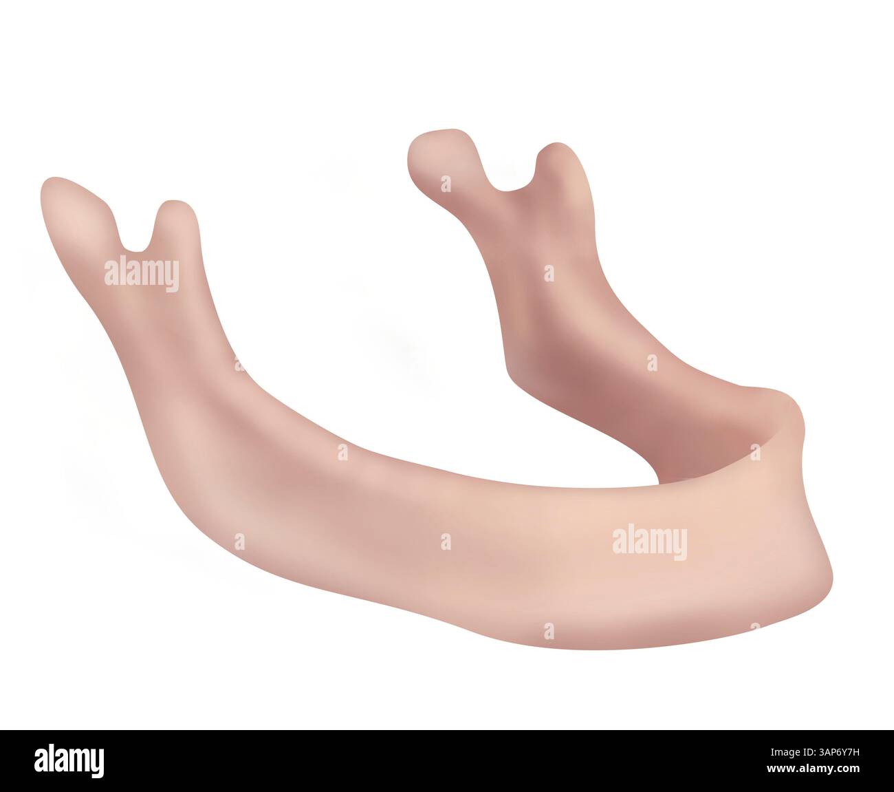 Illustration of a resorbed mandibular edentulous jaw, showing the ...