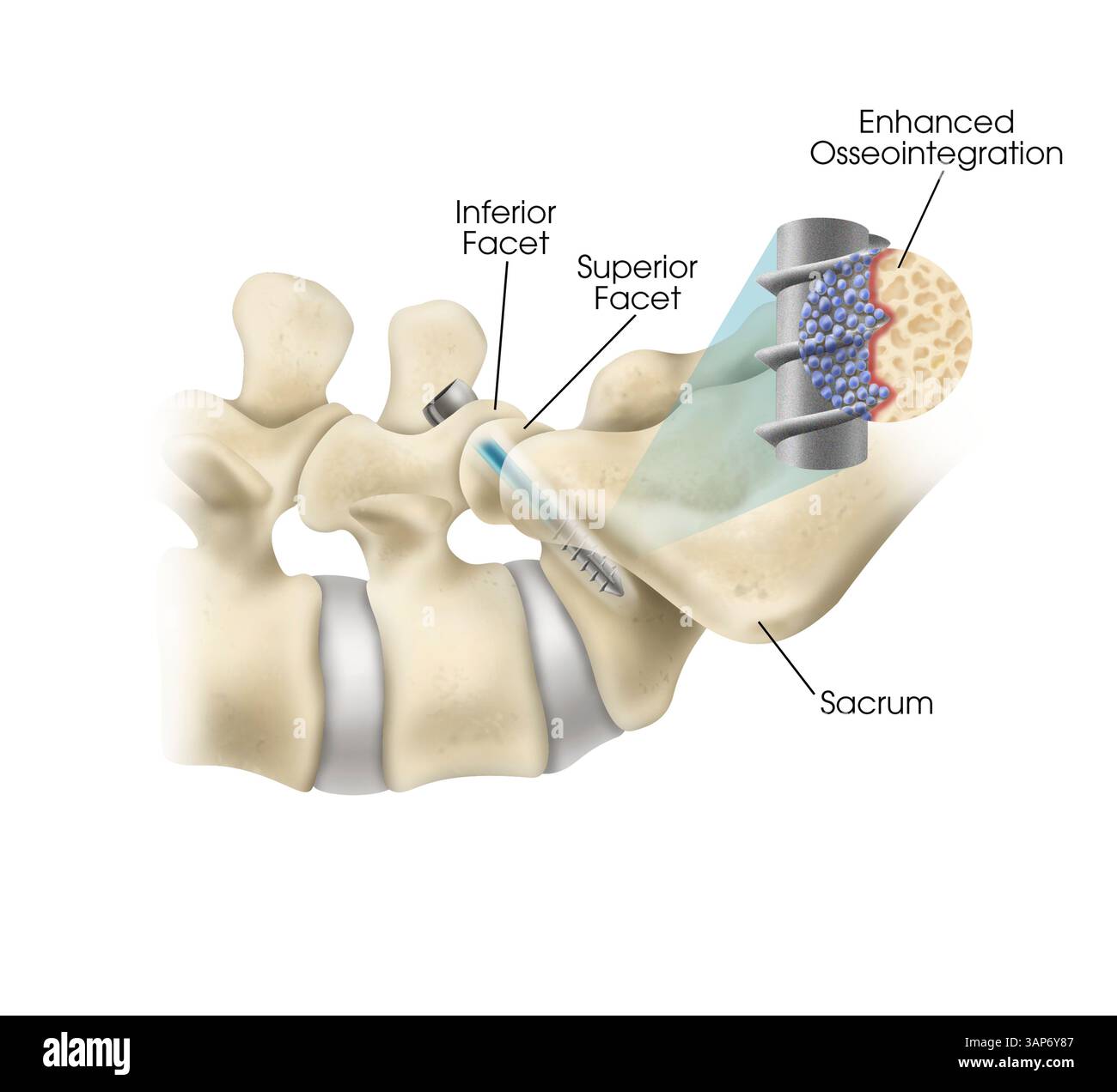 Illustration of a lateral view of the sacrum and pelvis showing an ...