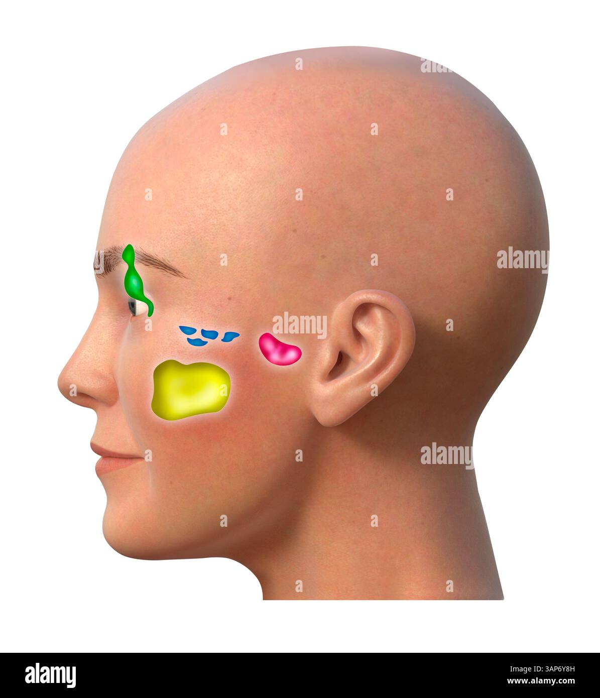 Illustration of a human face (side view) showing the sinuses and nasal ...