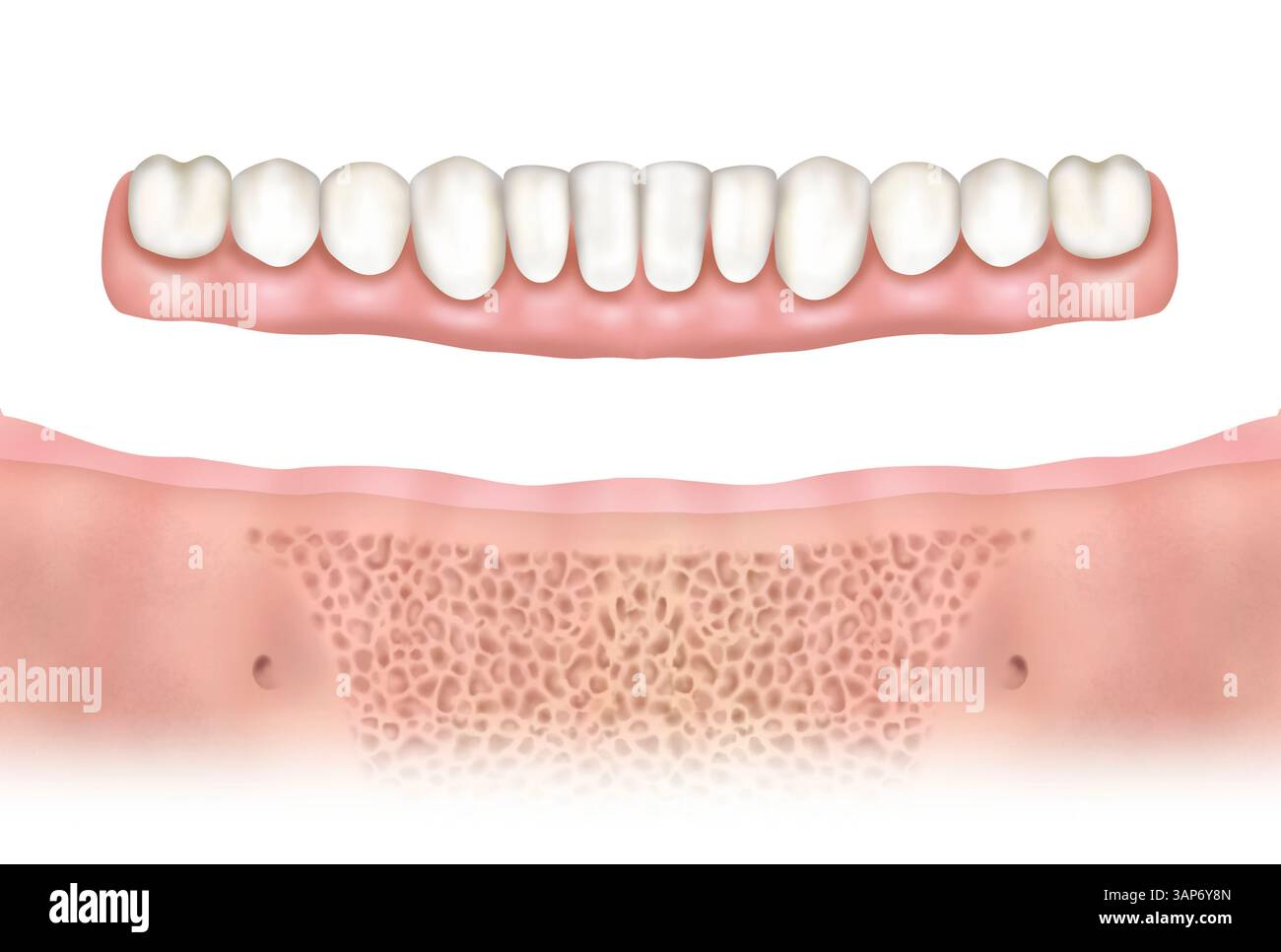 Illustration of a mandibular (lower jaw) arch 12-tooth prosthesis with ...
