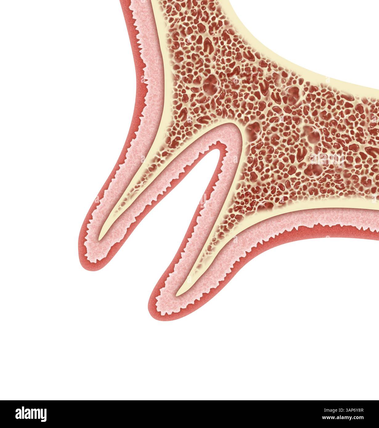 Illustration of a buccolingual cross-section showing a healed open ...
