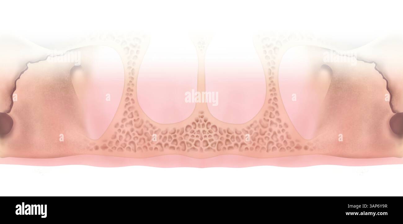 Illustration of a maxillary (upper jaw) arch with a cross-section of ...