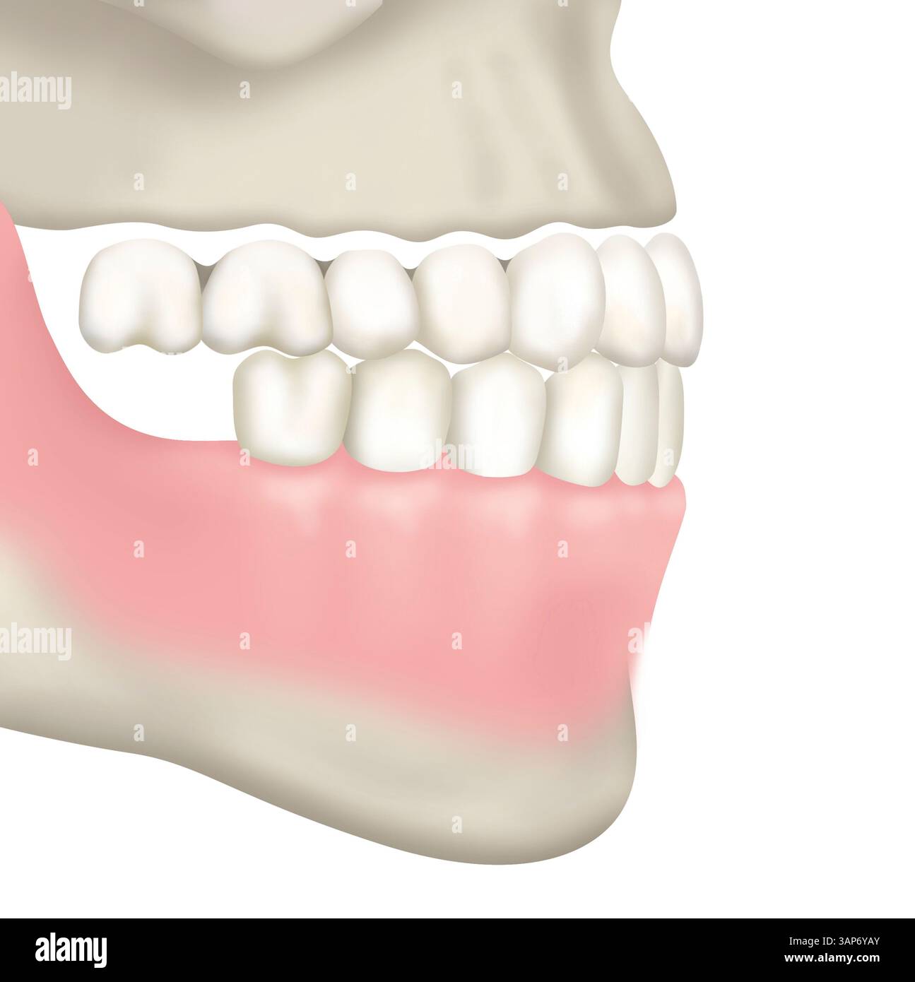 Illustration showing a lateral view of a normal mandible (lower jaw ...