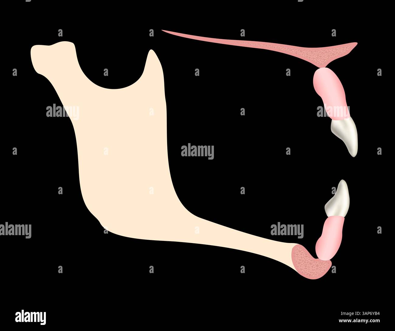 Illustration showing jaw resorption in relation to the presence of a ...
