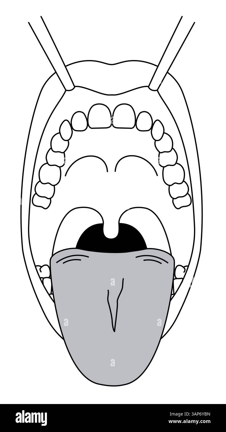 Illustration of the anatomical structures of the open mouth, including ...