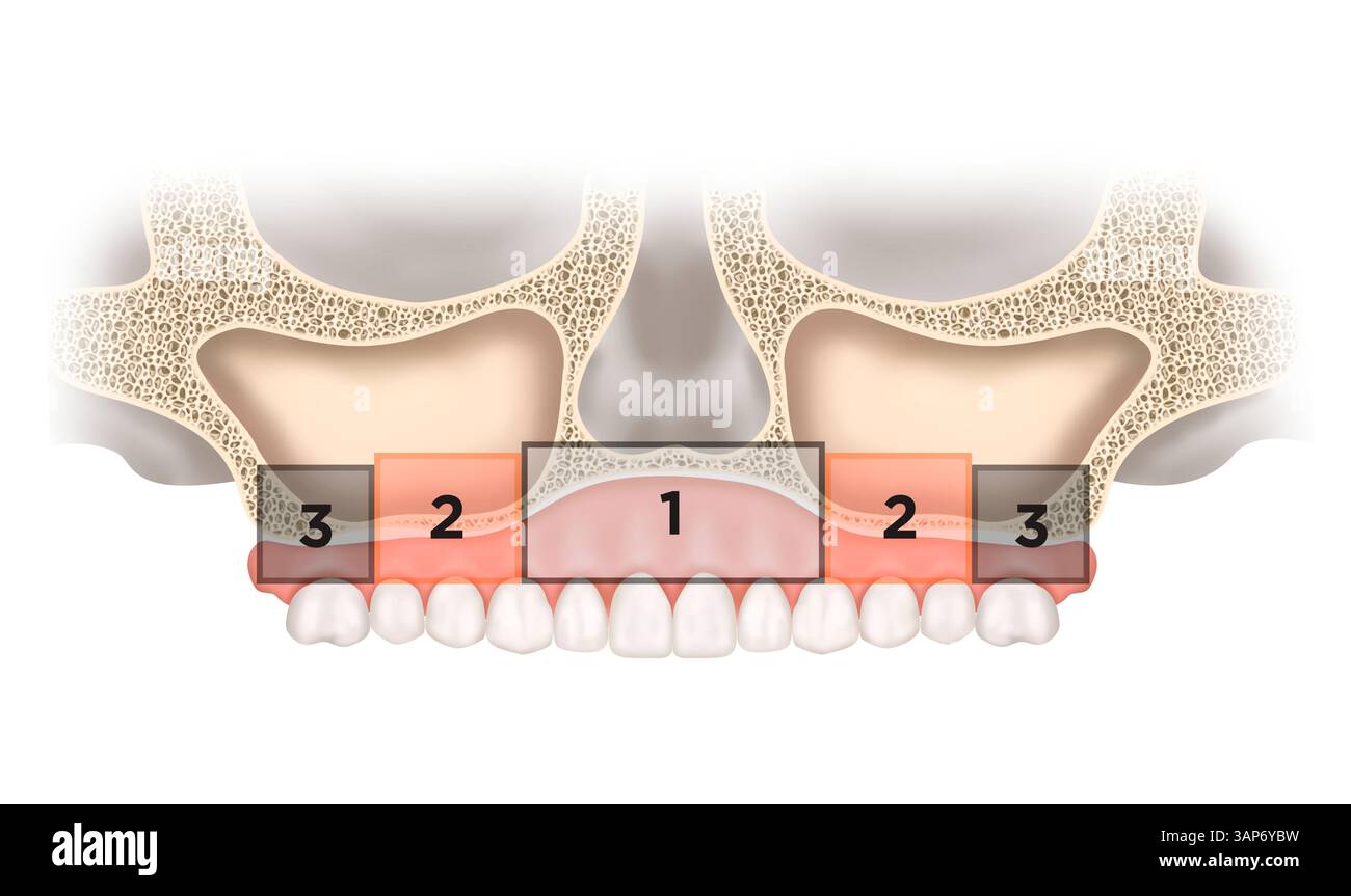Illustration of a cross-section of the paranasal region, showing a ...