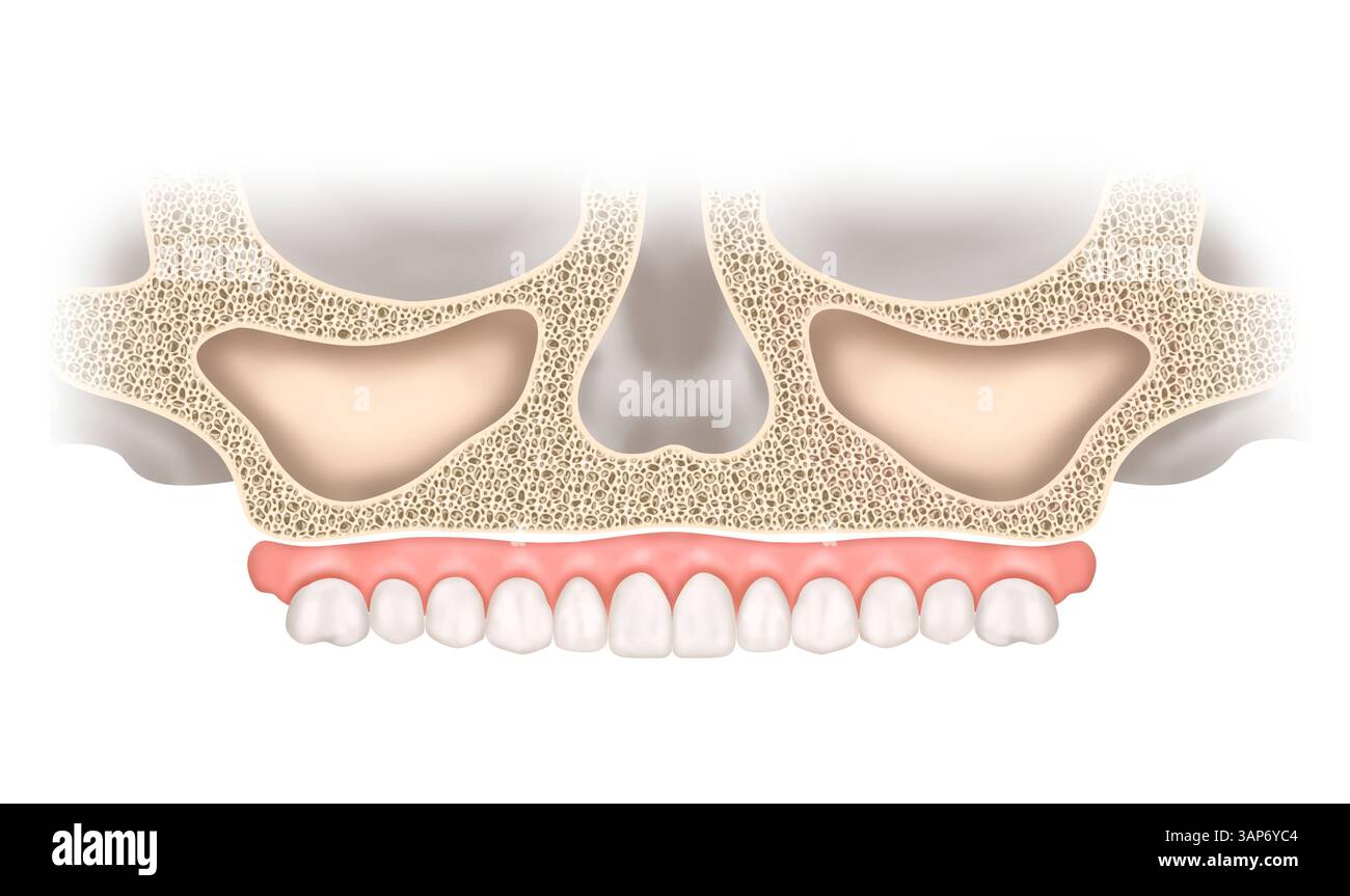 Illustration of a cross-section of the paranasal region, showing a ...
