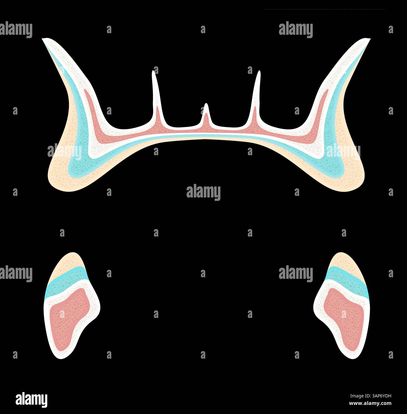 Illustration of a paranasal section through a maxilla (upper jaw) and ...