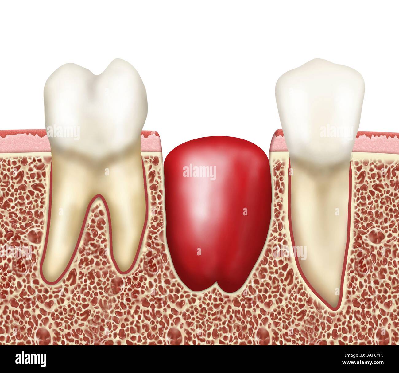 Illustration of a mesiodistal cross-section of teeth showing the ...