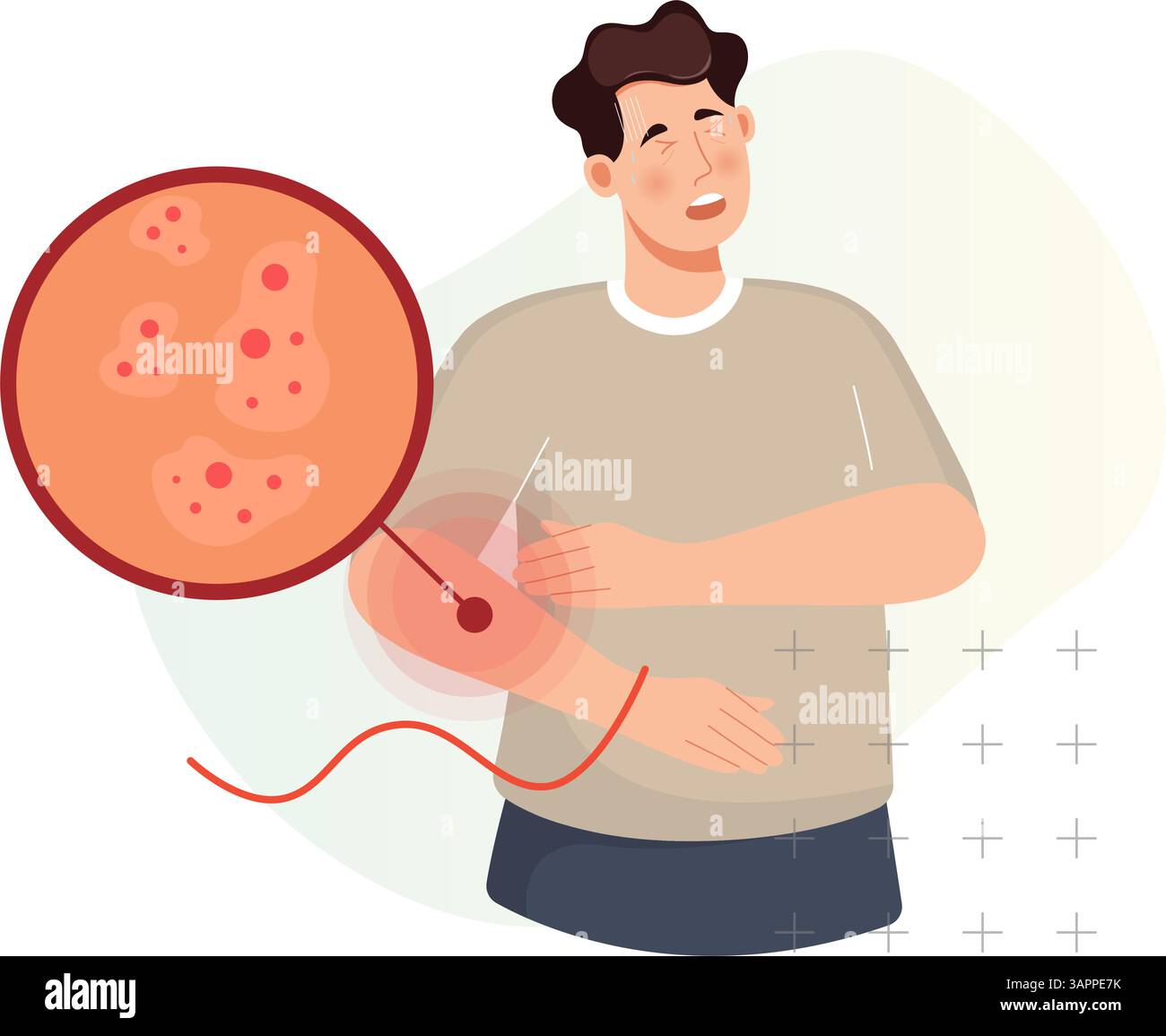 Skin allergy symptoms treatment Cut Out Stock Images & Pictures - Alamy