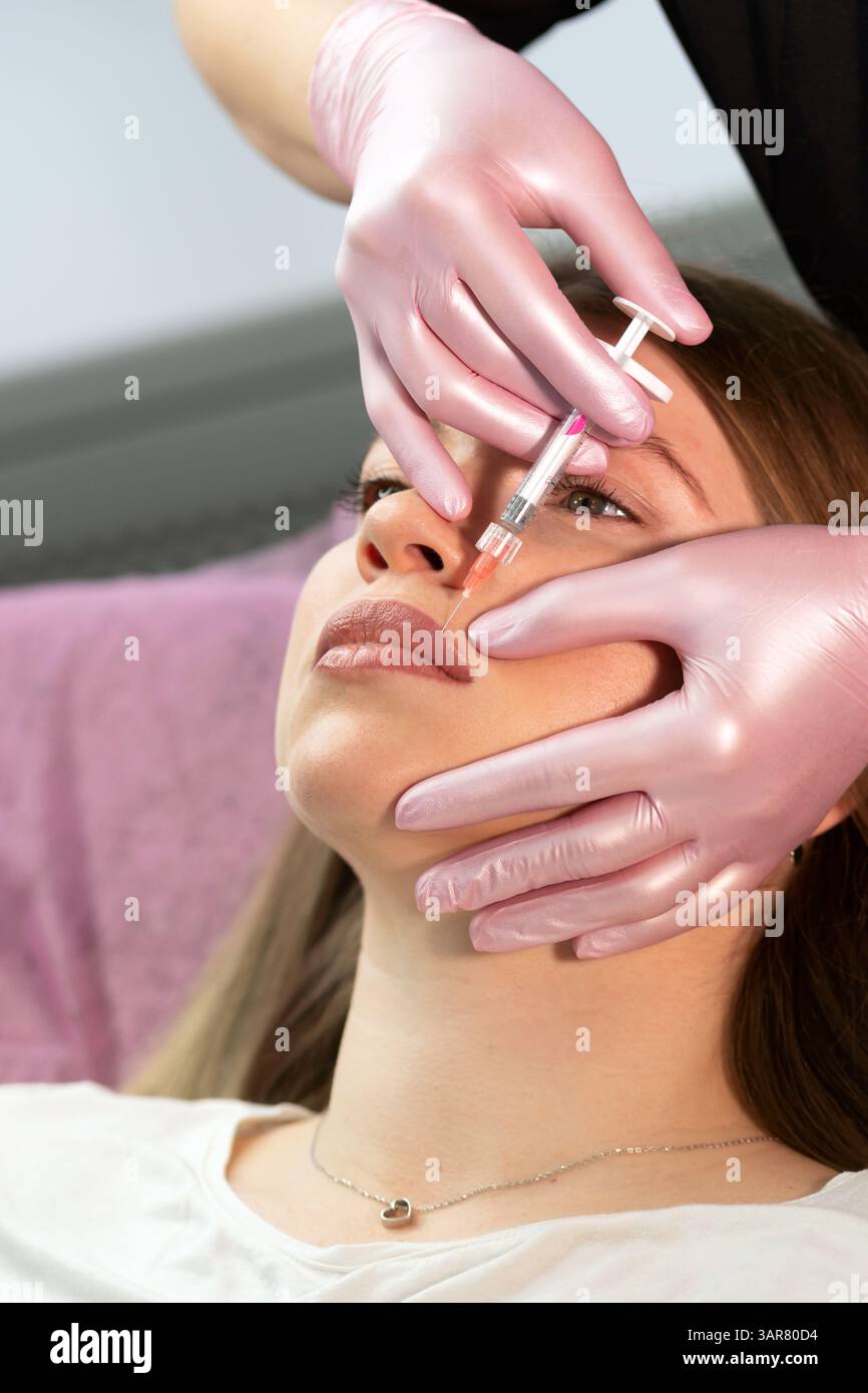 Aesthetician injects lip filler near patient’s nasolabial fold ...