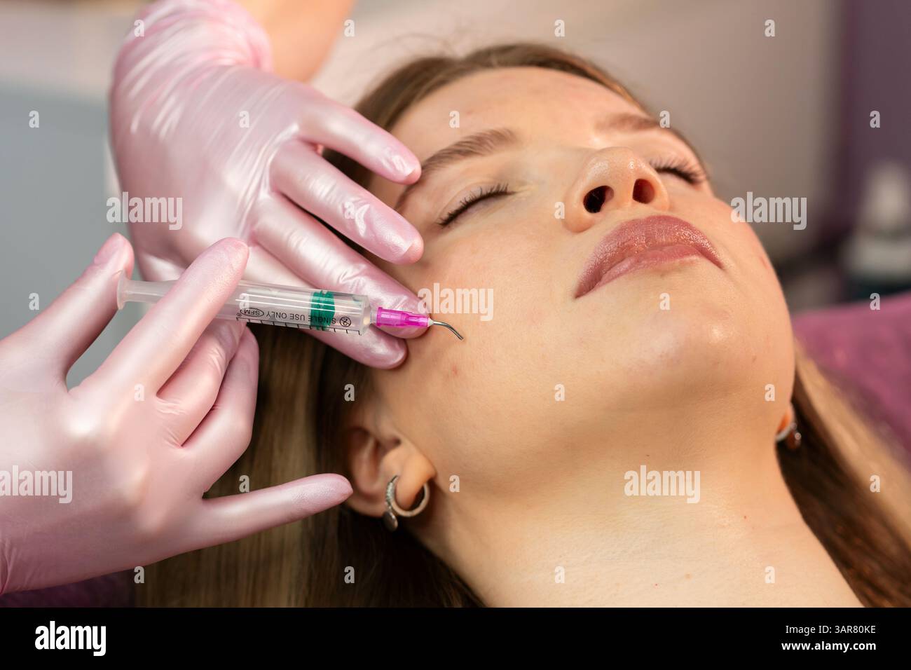 Aesthetician applying curved‑needle facial peel care on patient ...