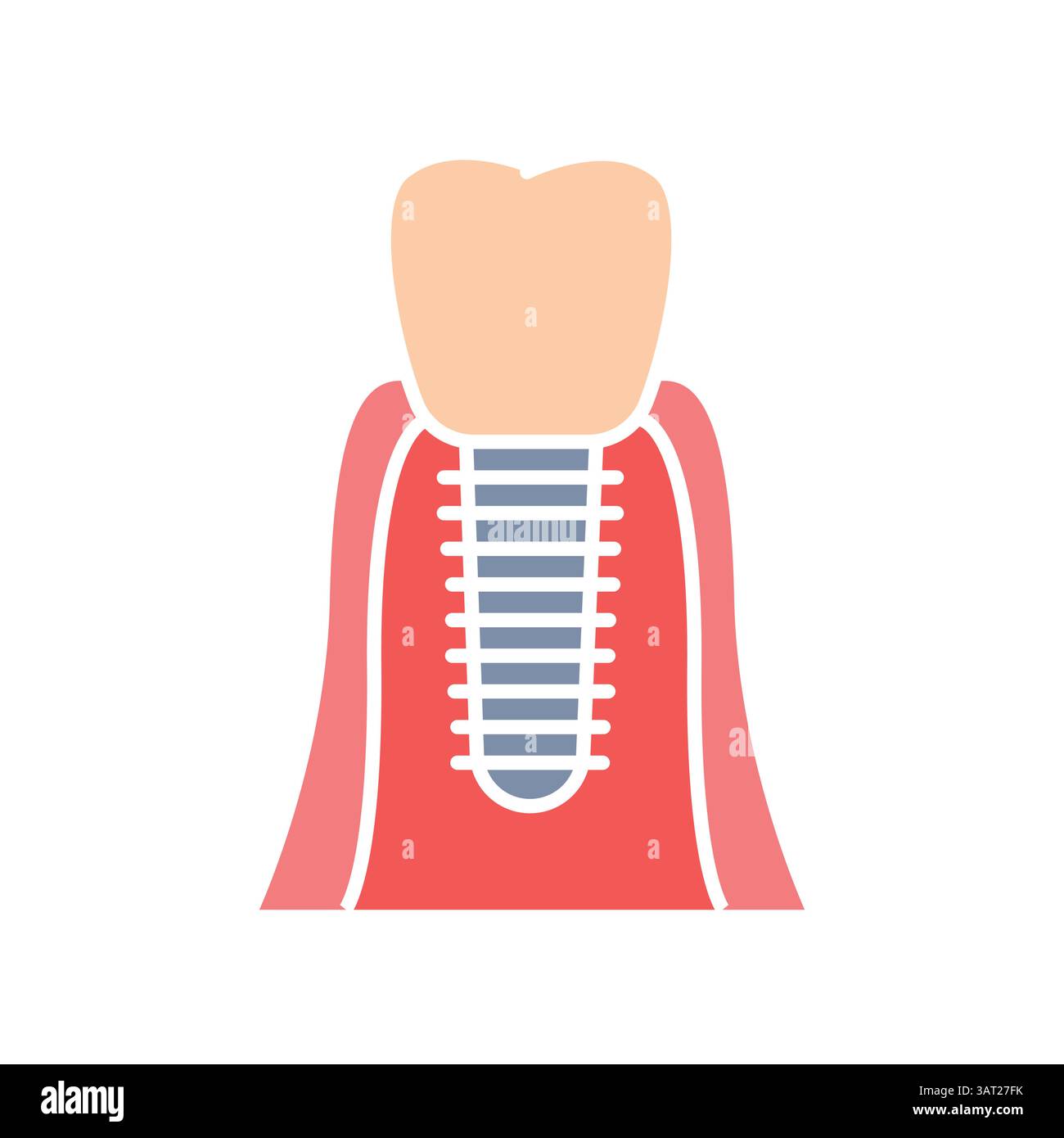 dental implant color flat icon for digital and print projects. Minimal clean icons for apps and ...