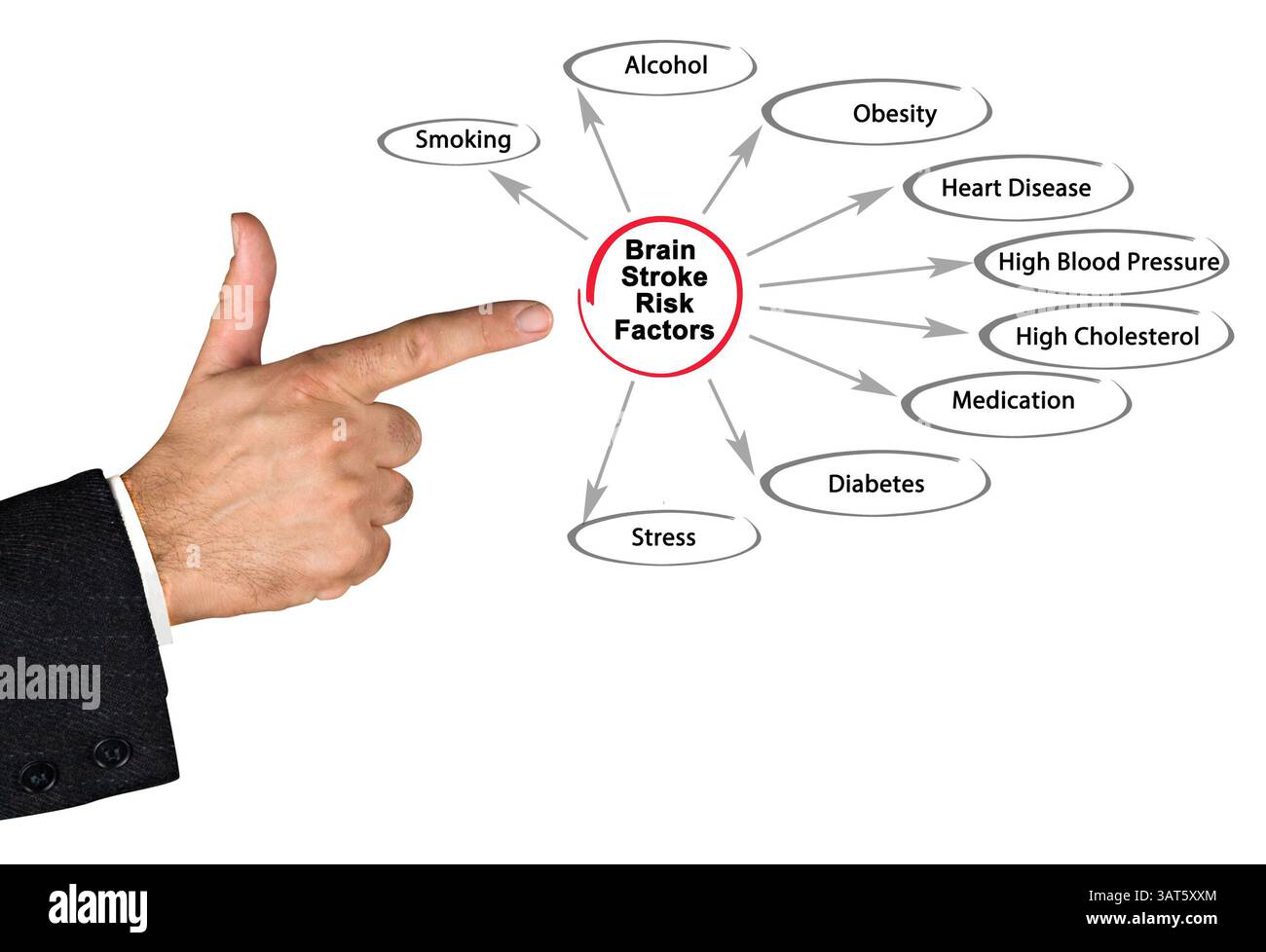 Nine Risk Factors for Brain Stroke Stock Photo - Alamy