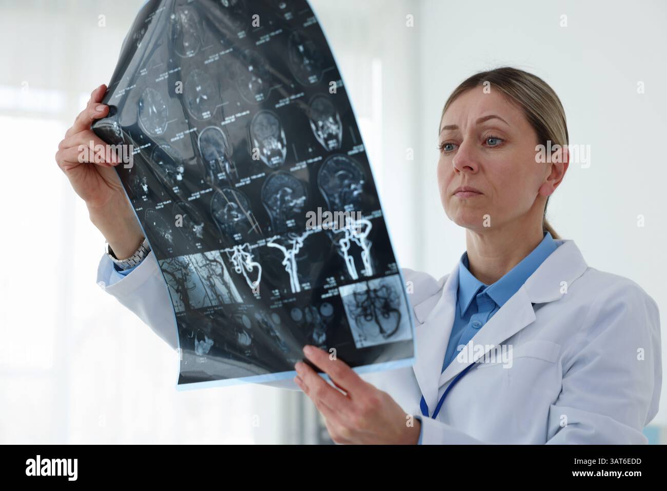Doctor examining brain MRI scan in hospital Stock Photo - Alamy