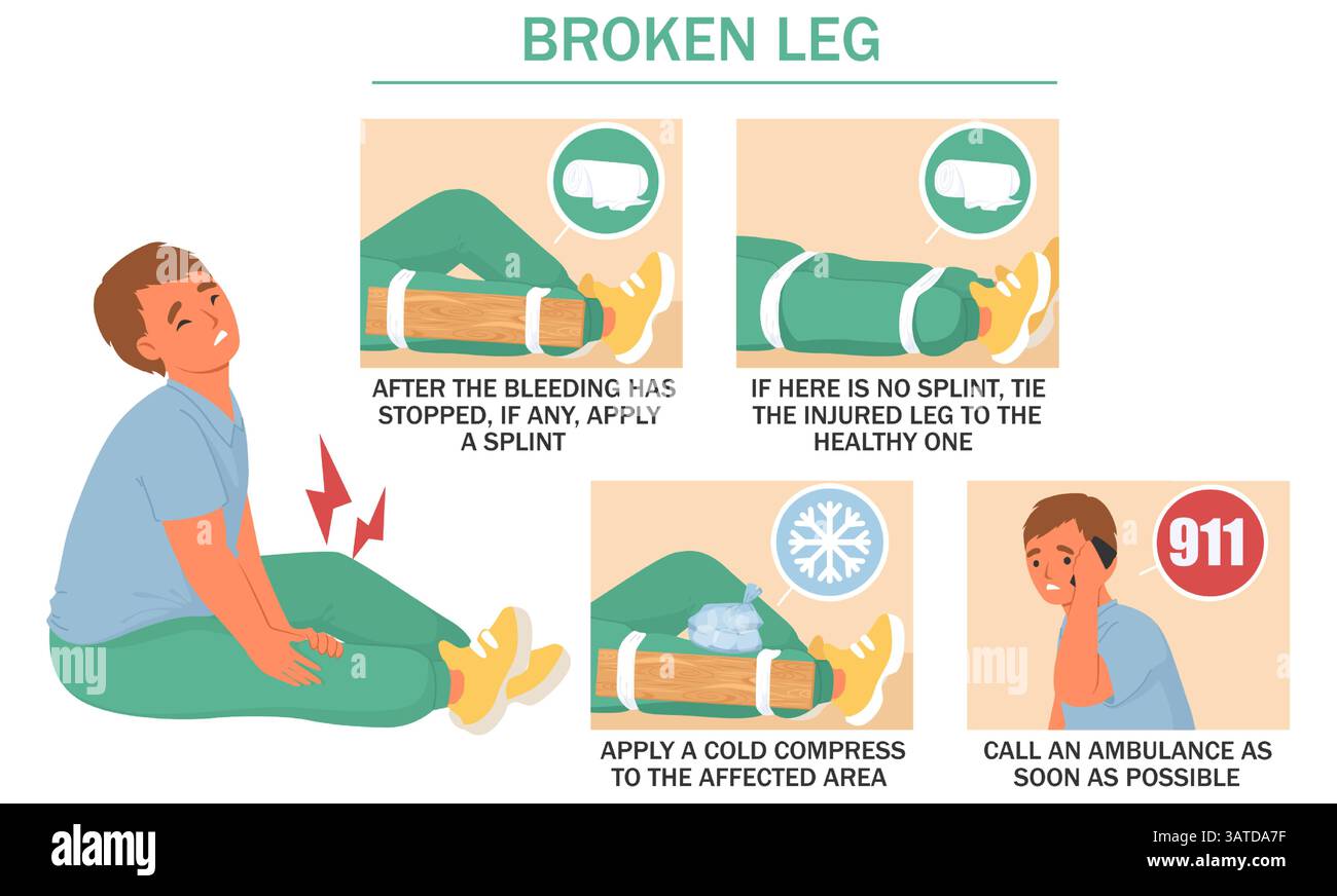 Clear instructions are provided for treating a broken leg, including ...