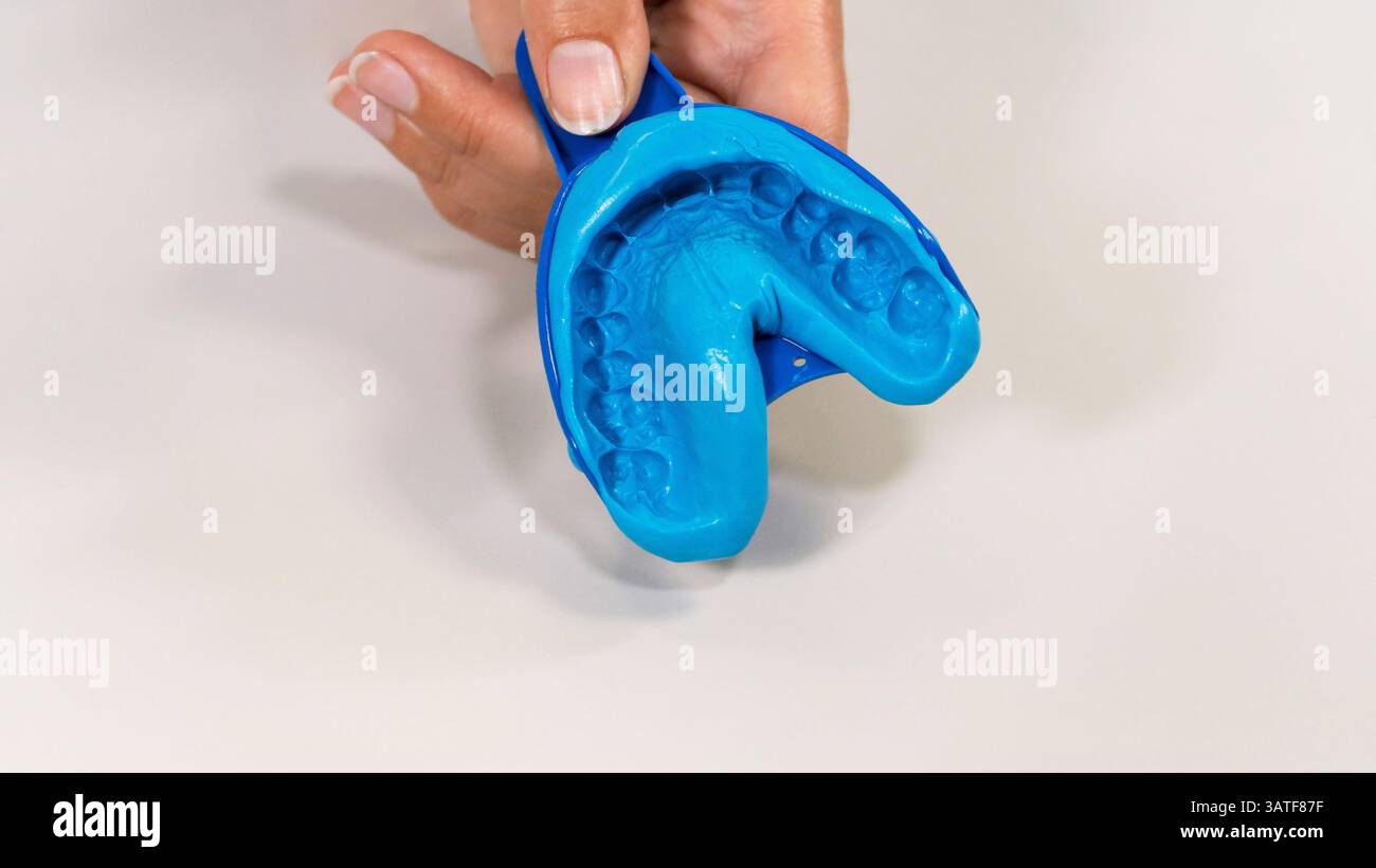 Close up of a dentist dental technique bite 3D impression teeth ...