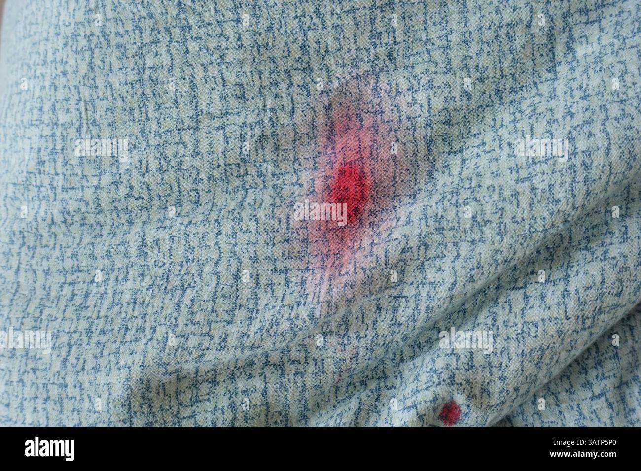 Red stain on fabric reveals an unexpected mishap during dining Stock ...