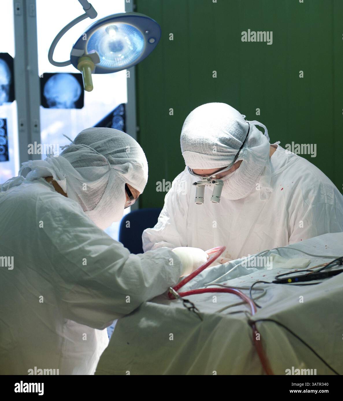 A real brain surgery, two surgeons at work Stock Photo - Alamy