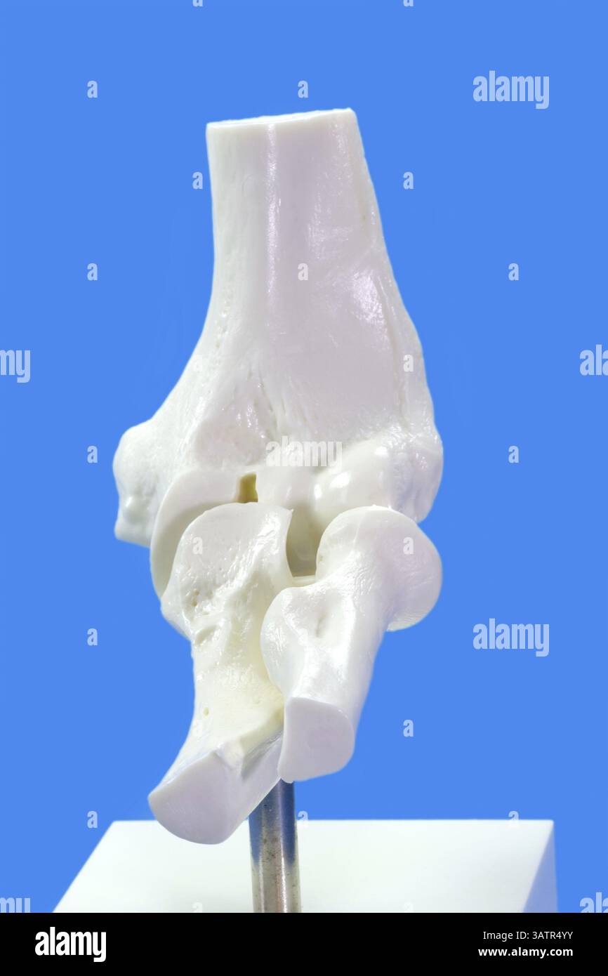 Teaching model of a human elbow joint Anatomy model from human elbow on ...